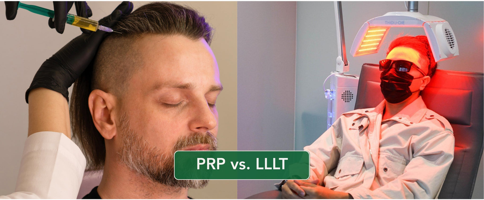 PRP vs. LLLT (Low-Level Laser Therapy) for Hair Loss: Which Works Better?